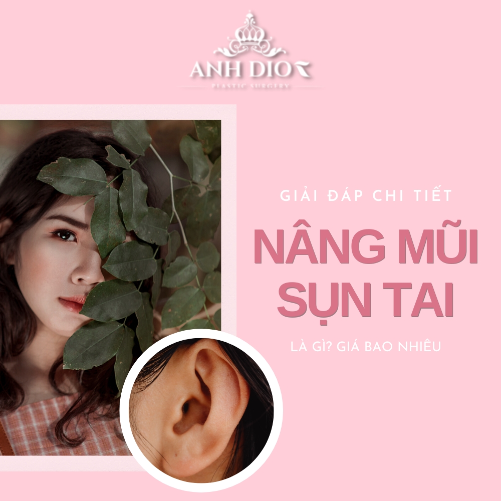Nâng mũi sụn tai là gì? Giá bao nhiêu? - Giải đáp chi tiết