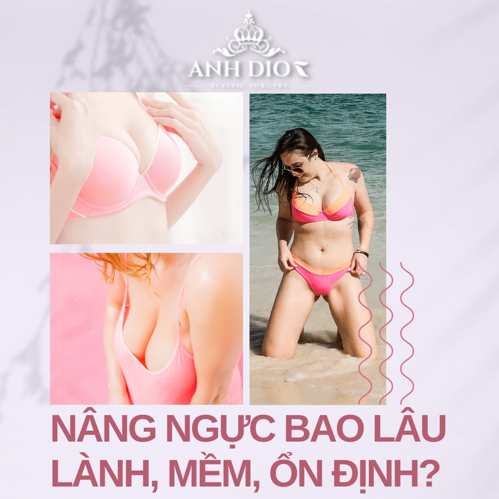 Phẫu thuật nâng ngực bao lâu thì lành, ổn định và mềm?